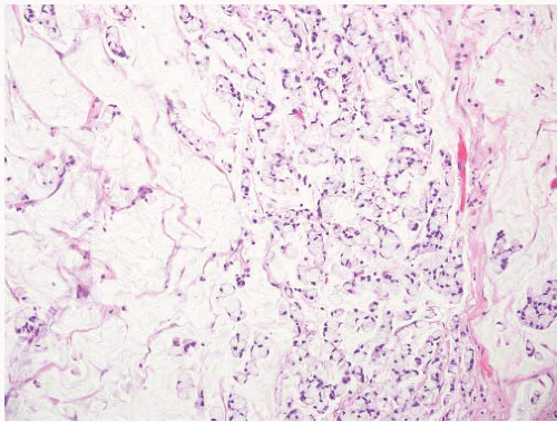 C6-FF129.gif | Abdominal Key