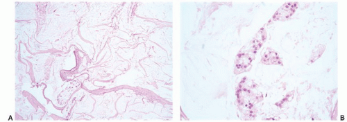 C6-FF136.gif | Abdominal Key