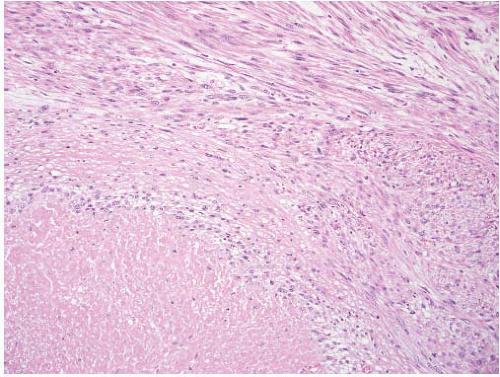 C6-FF159.gif | Abdominal Key