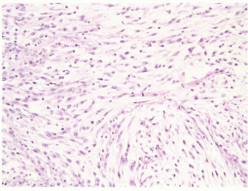 C6-FF160.gif | Abdominal Key