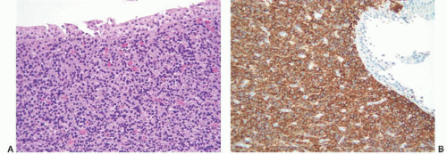 C6-FF163.gif | Abdominal Key