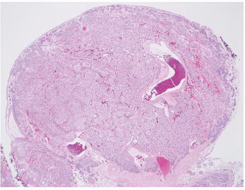 C6-FF166.gif | Abdominal Key