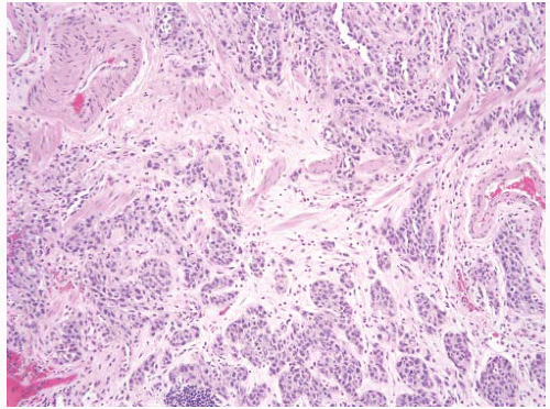 C6-FF182.gif | Abdominal Key