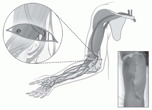 C6-FF2.gif | Abdominal Key