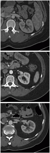 C6-FF2.gif | Abdominal Key