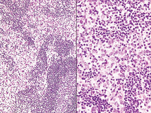 C6-FF30.gif | Abdominal Key