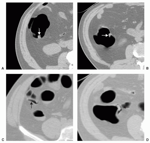 C6-FF31.gif | Abdominal Key