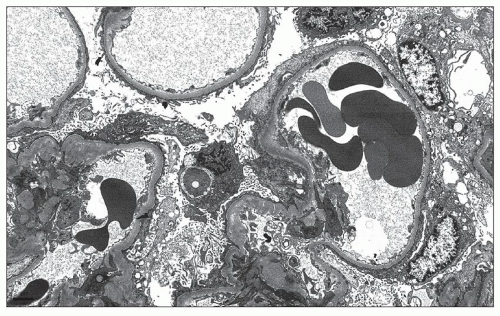 C6-FF39.gif | Abdominal Key