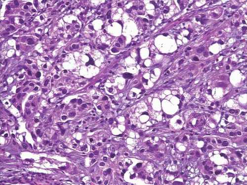 C6-FF47.gif | Abdominal Key