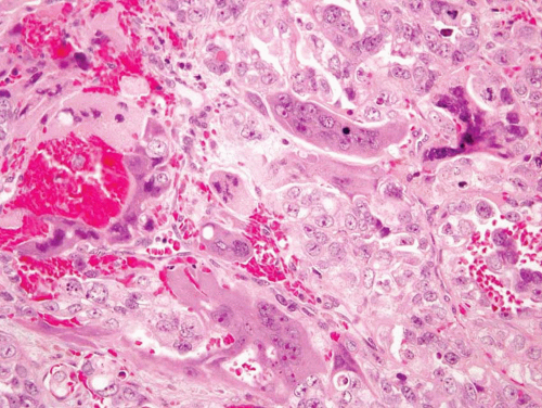 C6-FF50.gif | Abdominal Key