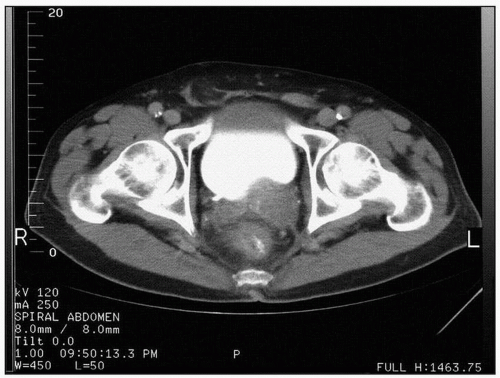 C6-FF6.gif | Abdominal Key