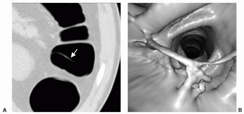 C6-FF60.gif | Abdominal Key
