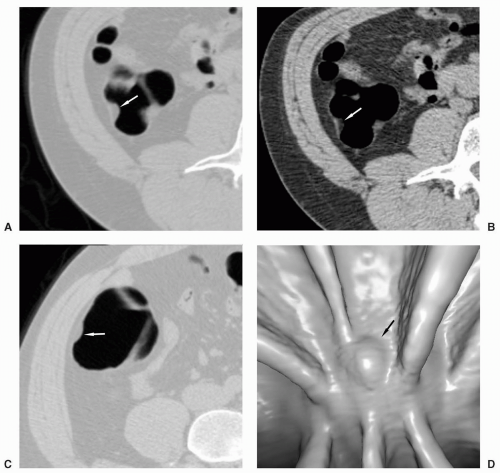 C6-FF63.gif | Abdominal Key
