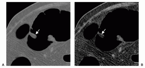 C6-FF64.gif | Abdominal Key