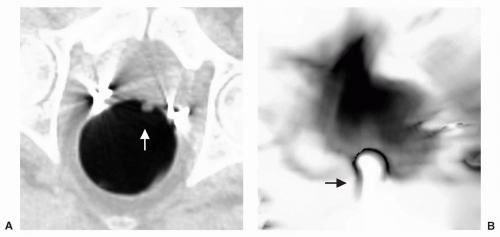 C6-FF92.gif | Abdominal Key