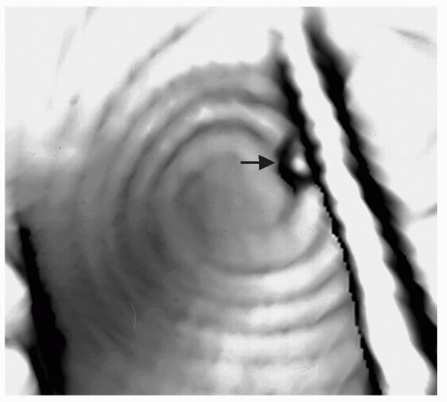 C6-FF96.gif | Abdominal Key