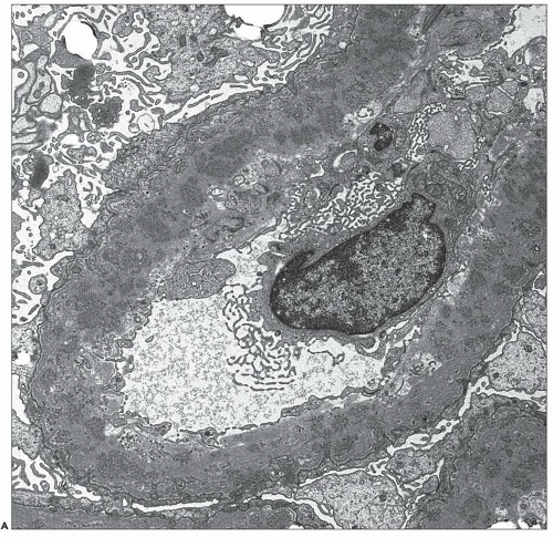 C7-FF30.gif | Abdominal Key