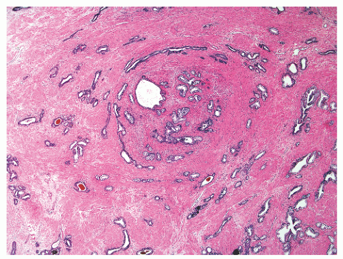 C8-FF111.gif | Abdominal Key