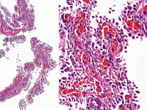 C8-FF48.gif | Abdominal Key