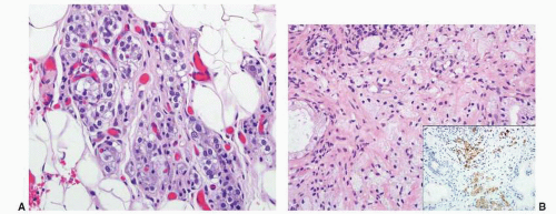 C9-FF100.gif | Abdominal Key
