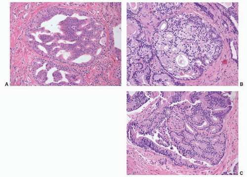 C9-FF138.gif | Abdominal Key