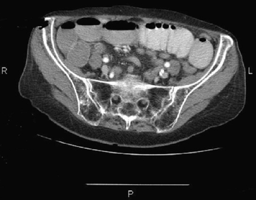 DA1C10FF13.gif | Abdominal Key