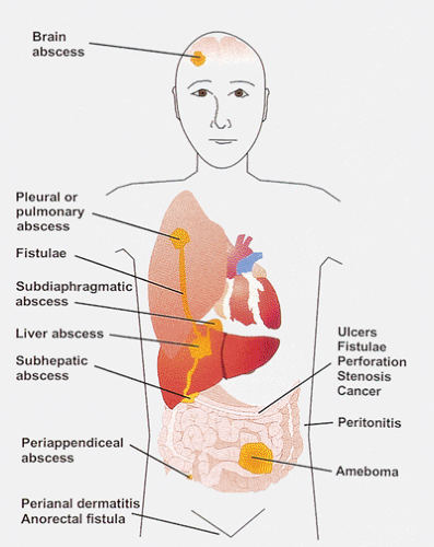 DA2C13FF124.gif | Abdominal Key