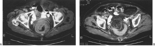 DA3C14FF138.gif | Abdominal Key