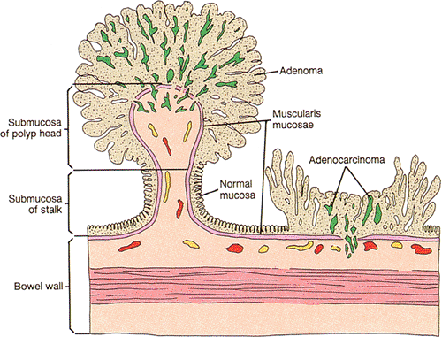 DA3C14FF57.gif | Abdominal Key