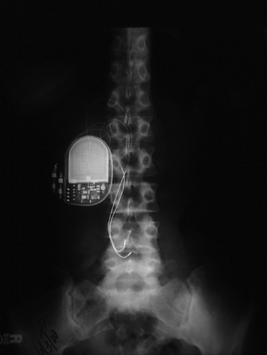 DA5C36FF5.gif | Abdominal Key