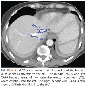 image00813.jpeg | Abdominal Key