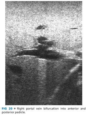 image00837.jpeg | Abdominal Key