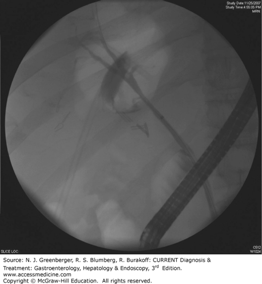 m_gre_ch33_f003.png | Abdominal Key