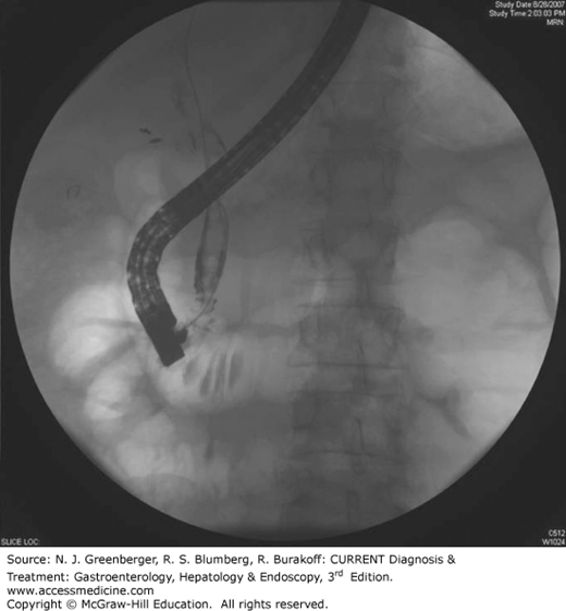 m_gre_ch33_f005.png | Abdominal Key