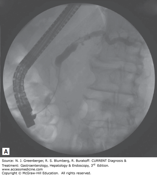 m_gre_ch36_f011a.png | Abdominal Key
