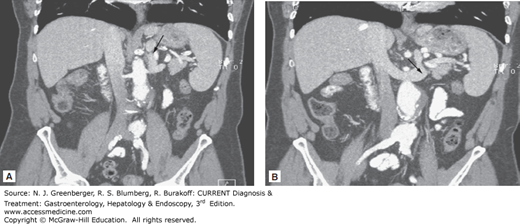 m_gre_ch45_f001.png | Abdominal Key