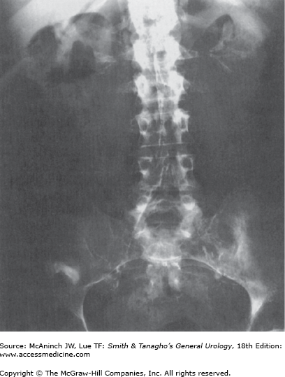 m_mcan18_c017f009.png | Abdominal Key