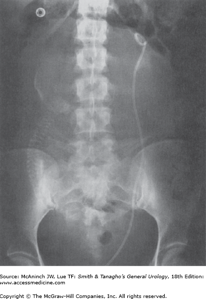 m_mcan18_c017f010.png | Abdominal Key