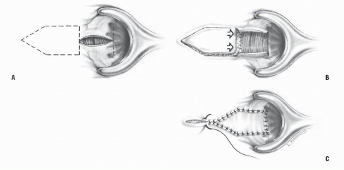 C11-FF77.gif | Abdominal Key