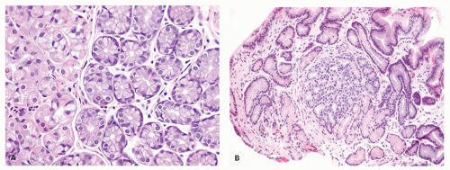 C12-FF20.gif | Abdominal Key