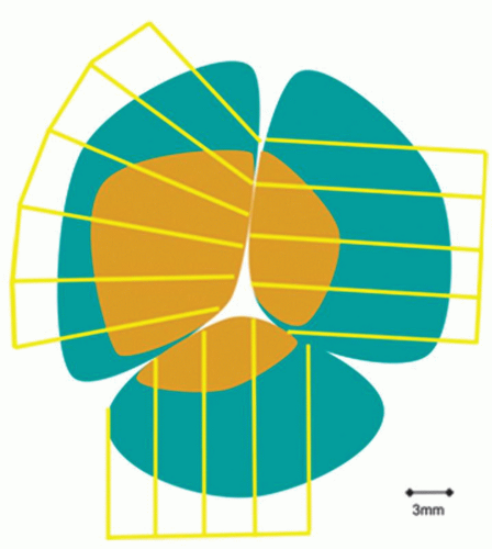 C14-FF48.gif | Abdominal Key