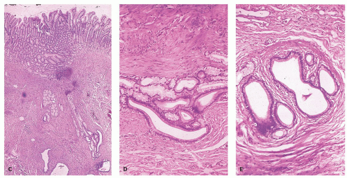 C14-FF67.gif | Abdominal Key