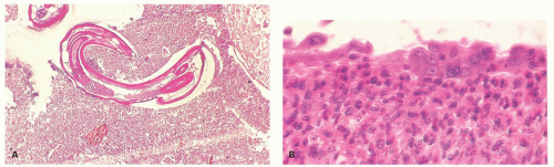C15-FF27.gif | Abdominal Key