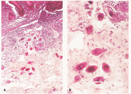 C15-FF28.gif | Abdominal Key
