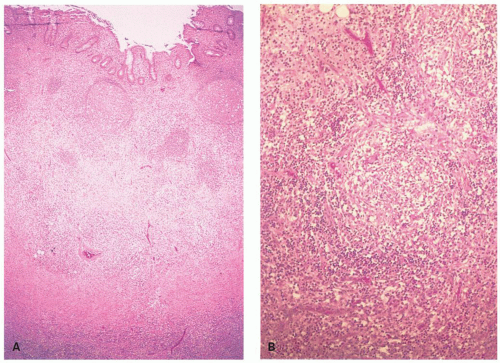 C15-FF30.gif | Abdominal Key