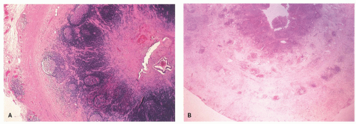 C15-FF31.gif | Abdominal Key