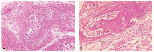 C15-FF34.gif | Abdominal Key