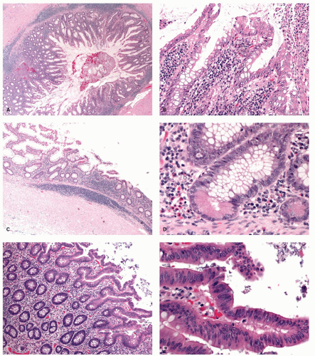 C15-FF38.gif | Abdominal Key