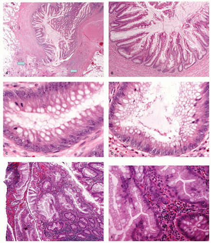 C15-FF41.gif | Abdominal Key