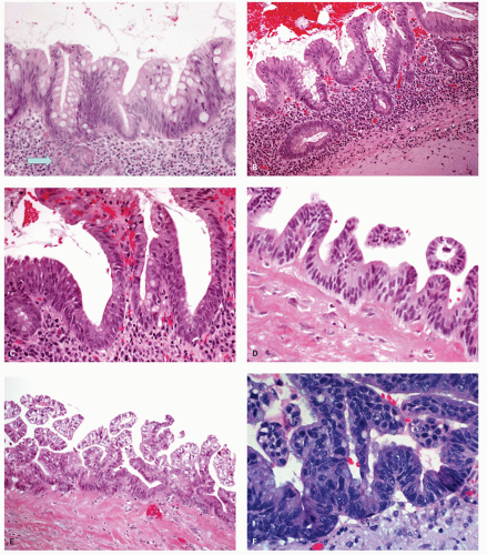 C15-FF46.gif | Abdominal Key